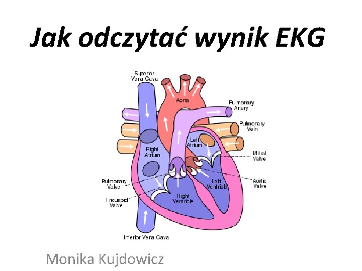 Jak odczyta wynik EKG Monika Kujdowicz Odprowadzenia V