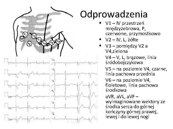 Jak odczyta wynik EKG Monika Kujdowicz Odprowadzenia V