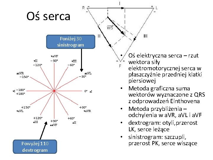Jak odczyta wynik EKG Monika Kujdowicz Odprowadzenia V