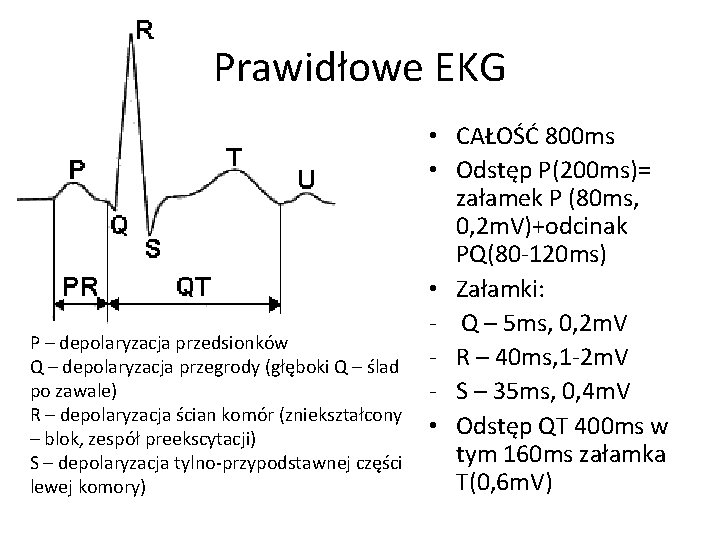 Jak odczyta wynik EKG Monika Kujdowicz Odprowadzenia V
