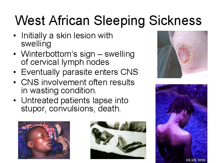 Tsetse Flies Oestrids Announcements Speaking Today Lauren Torbett