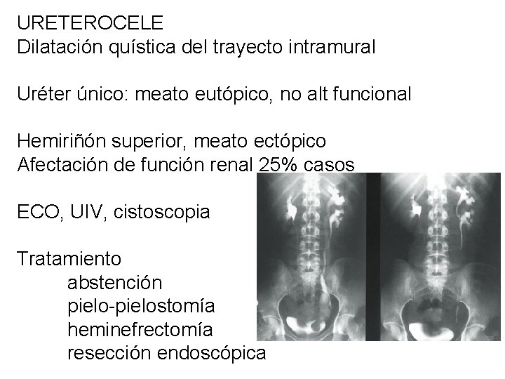 MALFORMACIONES CONGNITAS UROGENITALES MALFORMACIONES RENALES AGENESIA ...