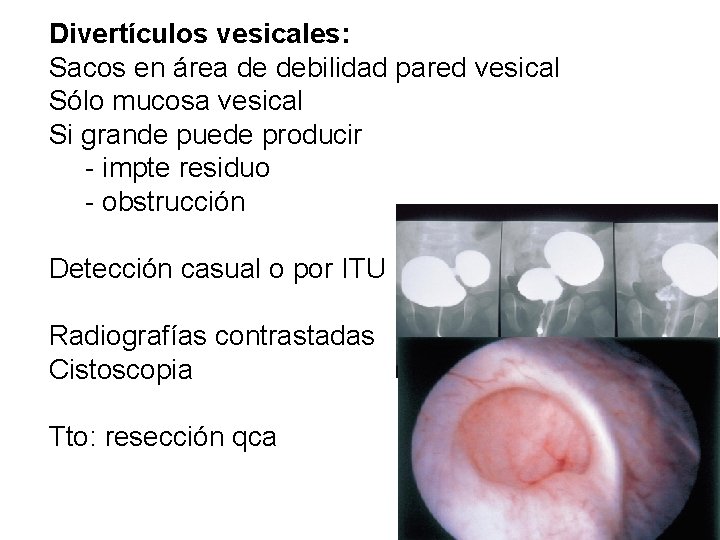 MALFORMACIONES CONGNITAS UROGENITALES MALFORMACIONES RENALES AGENESIA ...