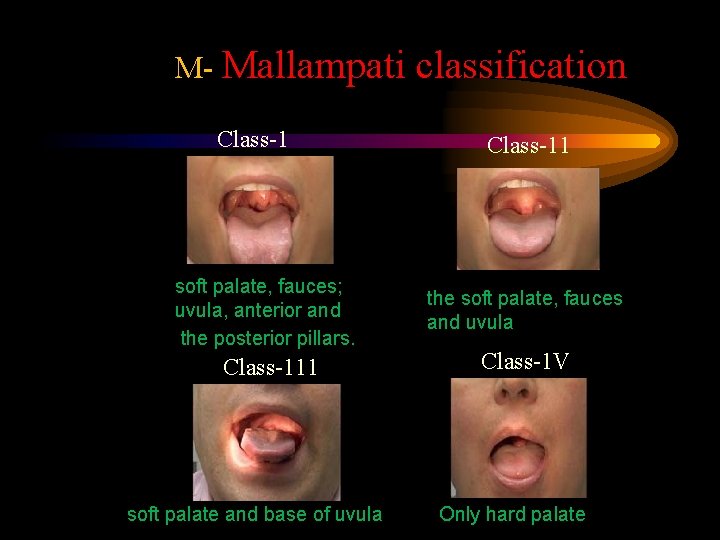 DIFFICULT AIRWAY MANAGEMENT When you cant breath nothing