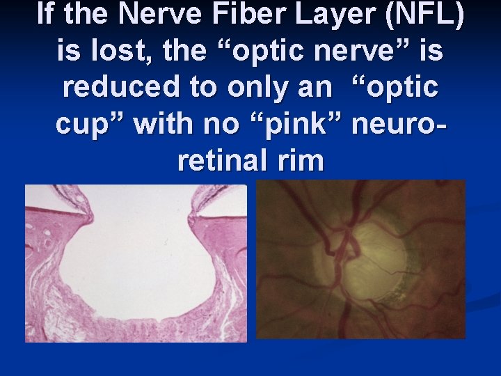 Anatomy of the Eye II histology and retinal