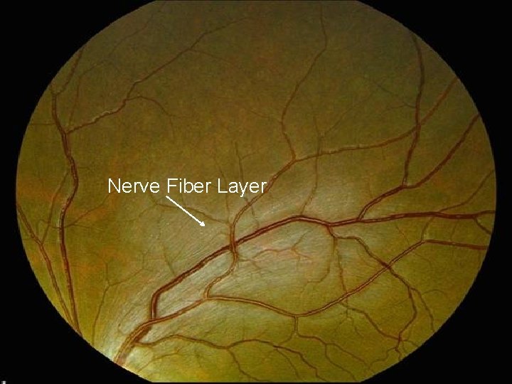 Anatomy of the Eye II histology and retinal
