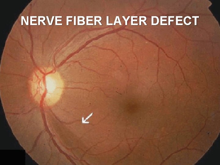 Anatomy of the Eye II histology and retinal