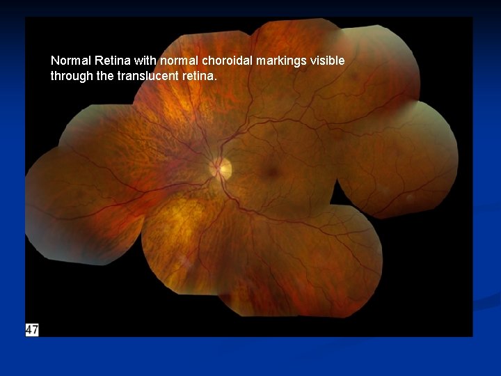 Anatomy of the Eye II histology and retinal