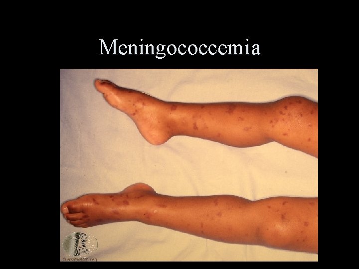 Dermatologic Emergencies Boston University School of Medicine Internal