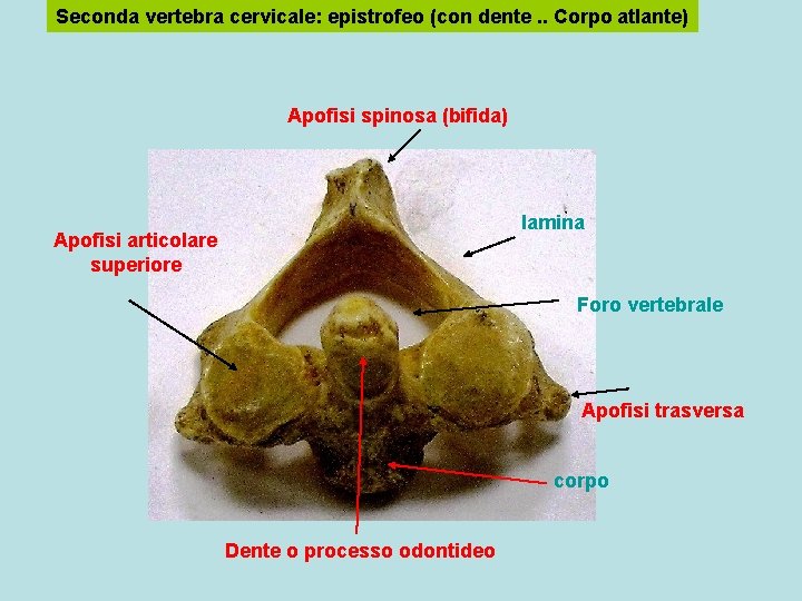 Apparato scheletrico tronco colonna vertebralevertebre gabbia toracica 12