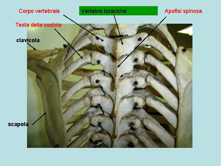 Apparato scheletrico tronco colonna vertebralevertebre gabbia toracica 12