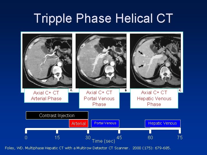 Detection of liver masses arterial phase imaging portal