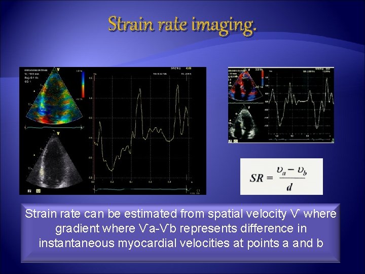 BASIC CONCEPTS AND PRINCIPLES OF TISSUE VELOCITY AND