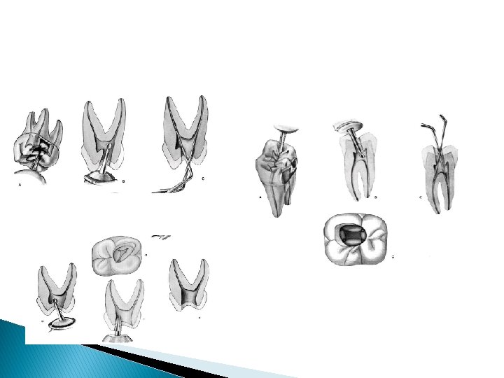 ROOT CANAL ANATOMY AND ACCESS CAVITY PREPERATION Dr
