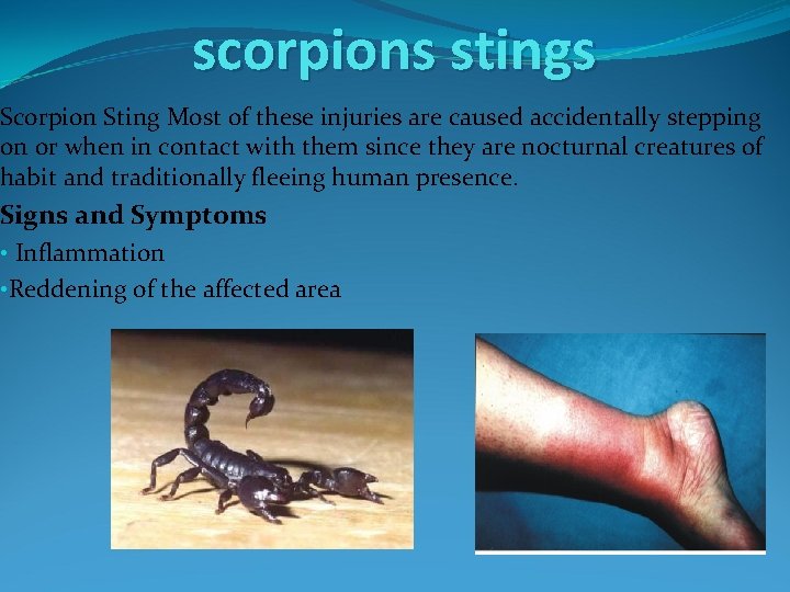 Insect Bite Stings and bites from insects are