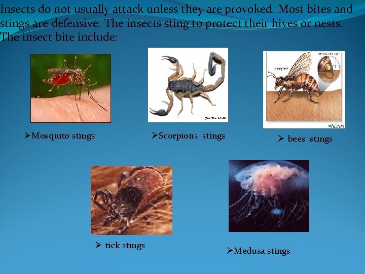 Insect Bite Stings and bites from insects are