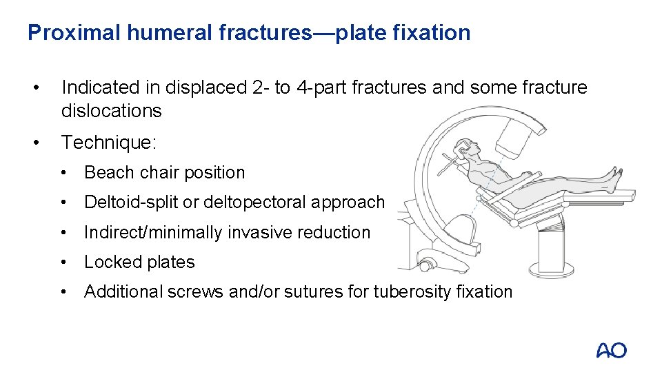 Proximal humeral fracturesan update on treatment protocols AO