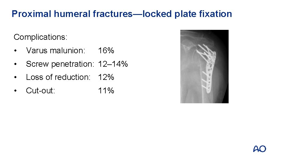 Proximal humeral fracturesan update on treatment protocols AO