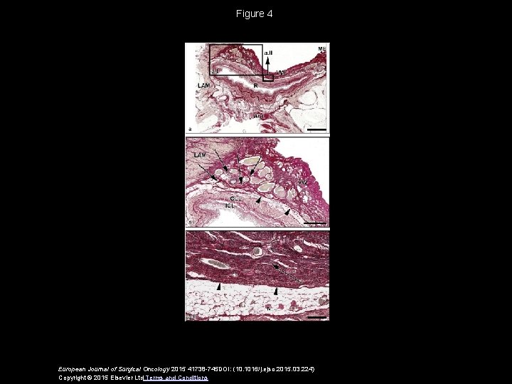 Whole mount microscopic sections reveal that Denonvilliers fascia