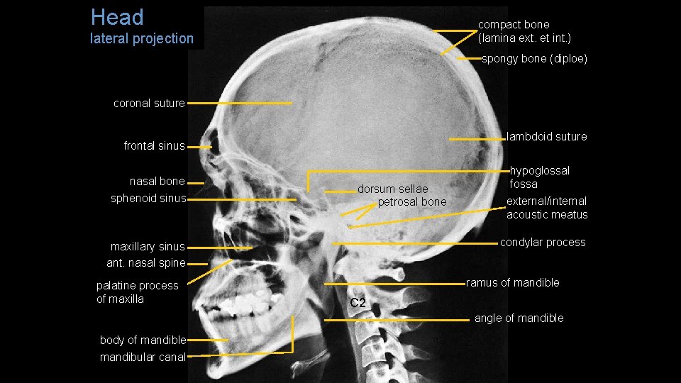 List of Xrays LOCOMOTOR SYSTM 1 Head axial