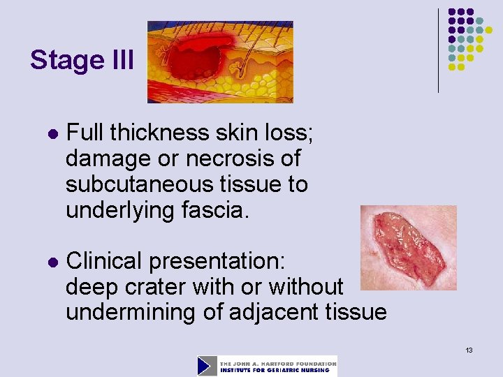 Pressure Ulcers in Older Adults Objectives l l