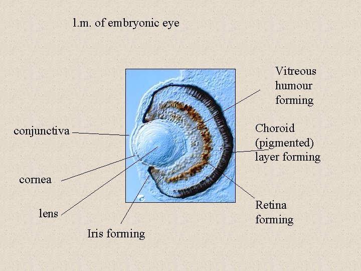 EYES l m of embryonic eye Vitreous humour