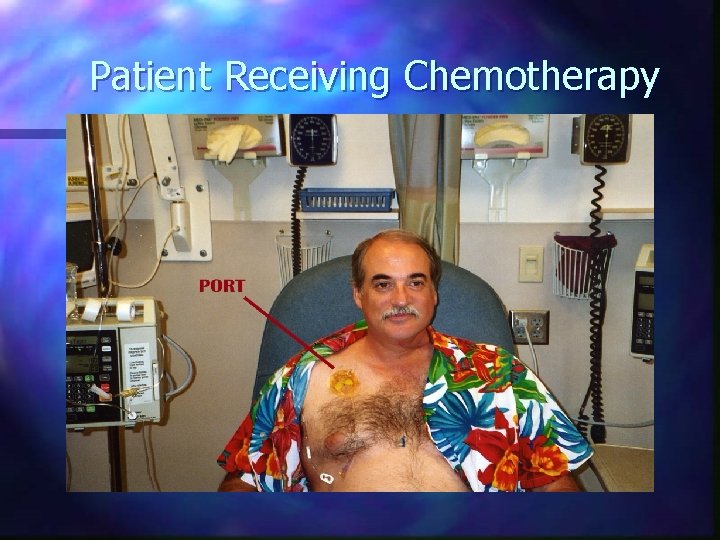 Chemotherapy Cancer Therapy Patient Receiving Chemotherapy Todays Class