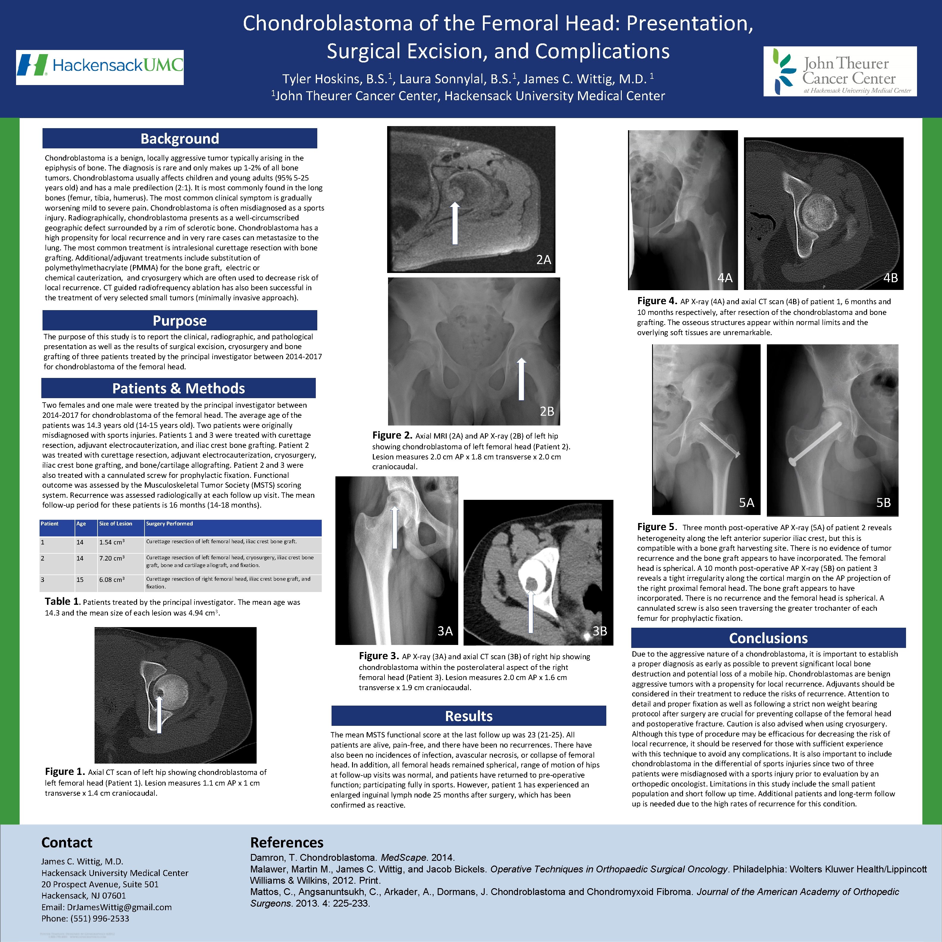 Chondroblastoma of the Femoral Head Presentation Surgical Excision
