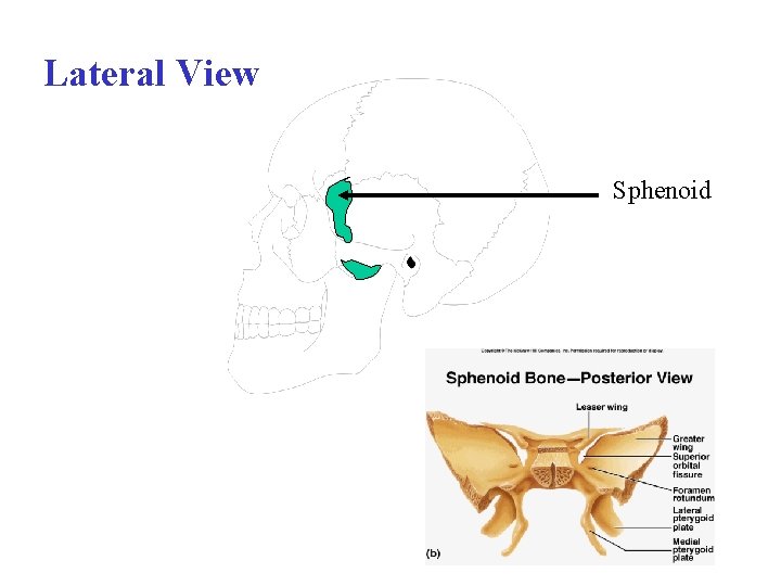 Agenda Bones of the Axial Skeleton Parts of