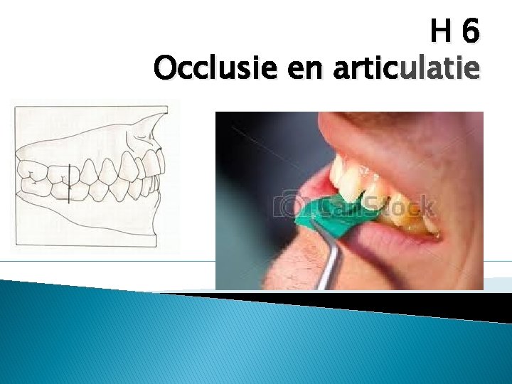 H 6 Occlusie en articulatie Occlusie op elkaar