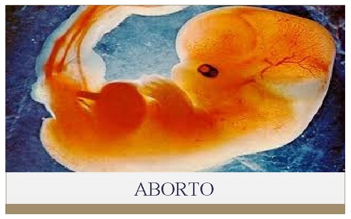 I Curso de Medicina Legal Junho2017 ABORTO CONCEITO