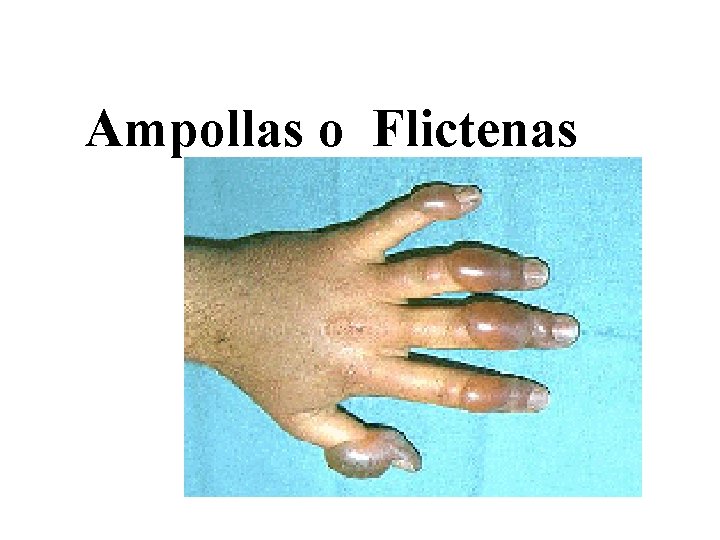 Estructuras de la piel EPIDERMIS Parte ms externa