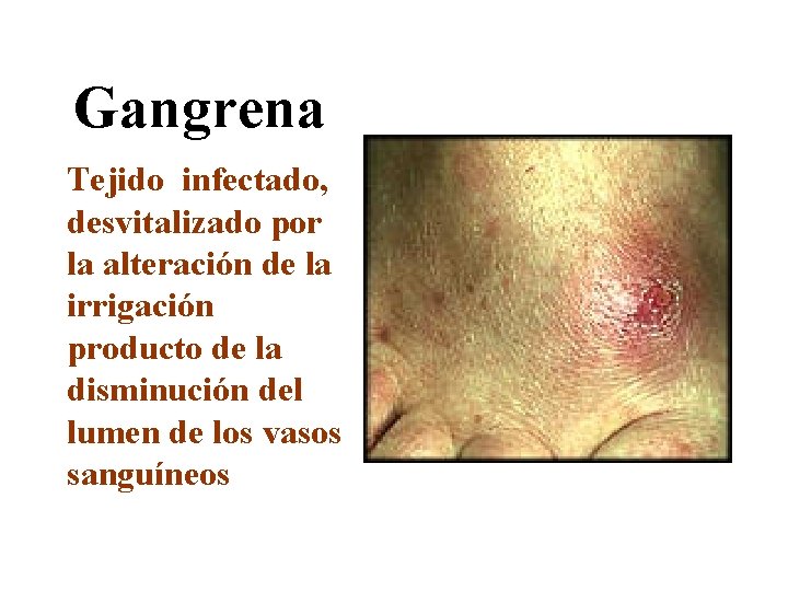 Estructuras de la piel EPIDERMIS Parte ms externa