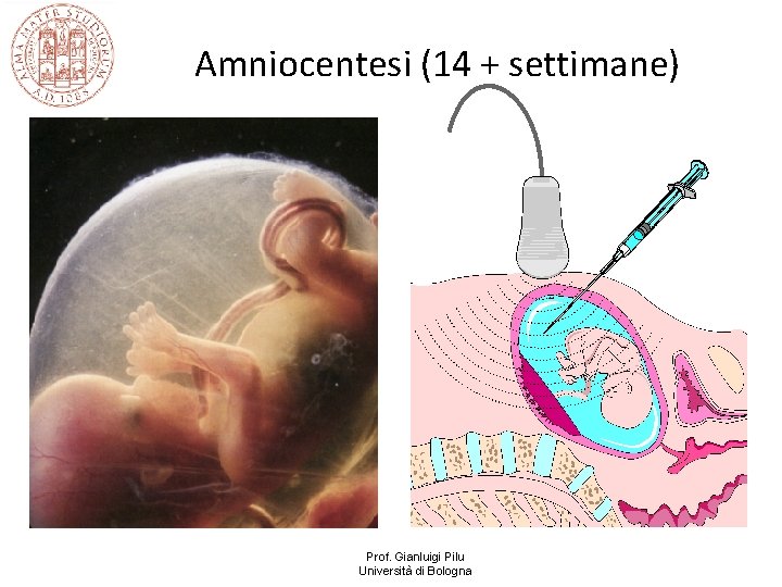 Clinica Ostetrica e Ginecologica lezione 5 La diagnostica