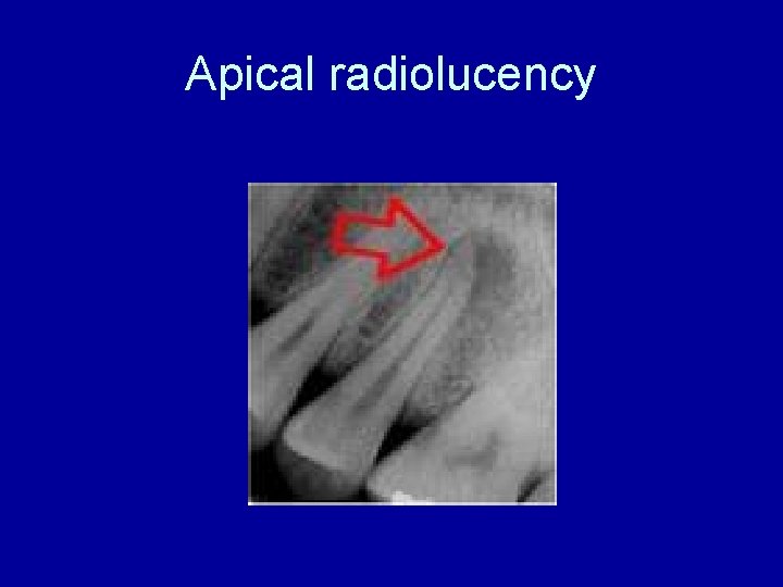 Root Structure and Supporting Tissue Permanent teethroot numbers