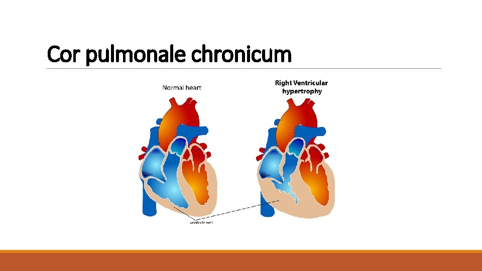 Kardiovaskulrn patologie I choroby srdce hypertenze akutn a