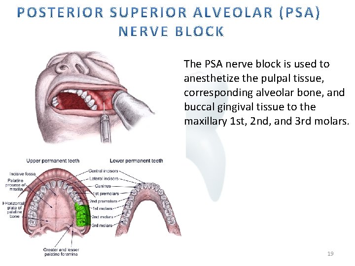 http yeditepedentistryanatomy wordpress com 1 The largest of