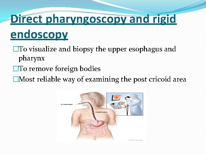 MANAGEMENT OF DYSPHAGIA Dysphagia Difficulty in swallowing which