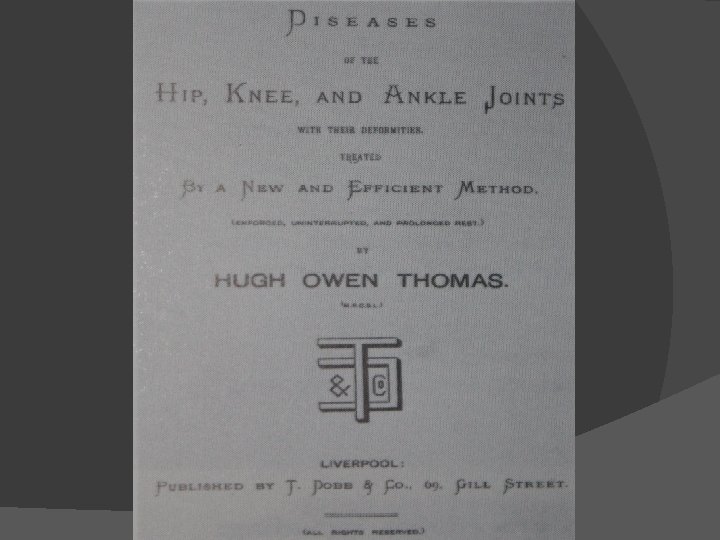 VENOUS THROMBOEMBOLIS M An Orthopods Perspective Adrian Beaumont