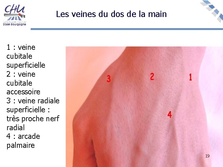 Examens de Biologie Mdicale Prlvements sanguins veineux priphriques