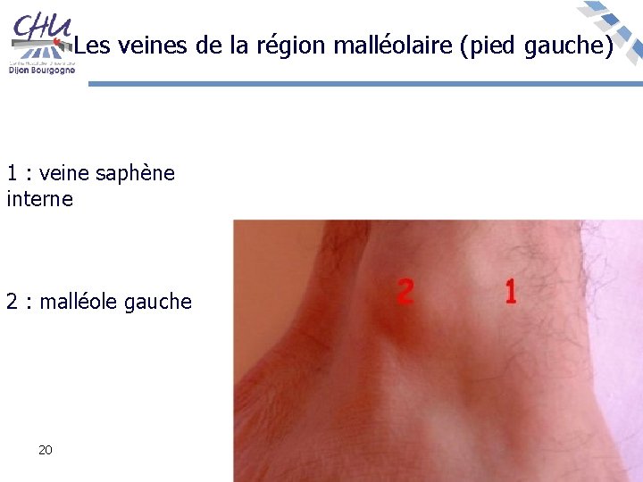 Examens de Biologie Mdicale Prlvements sanguins veineux priphriques