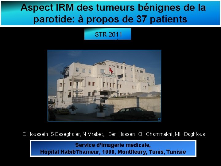 Aspect IRM des tumeurs bnignes de la parotide