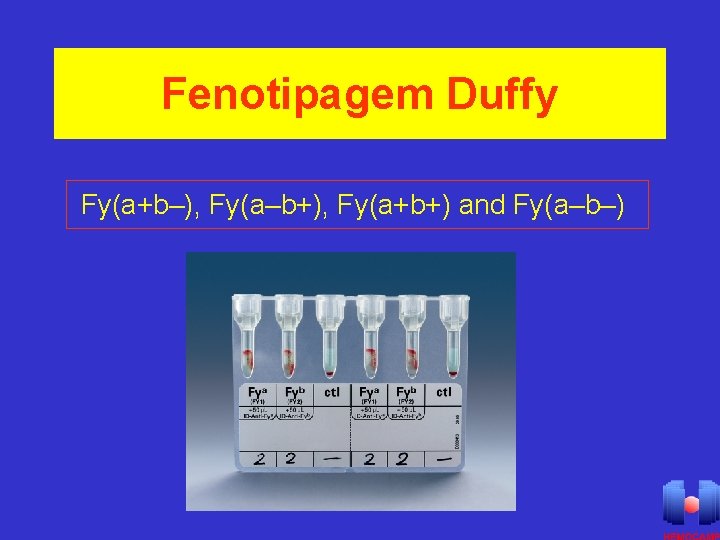 Outros Sistemas de Importncia Clnica Sistemas Kell Duffy