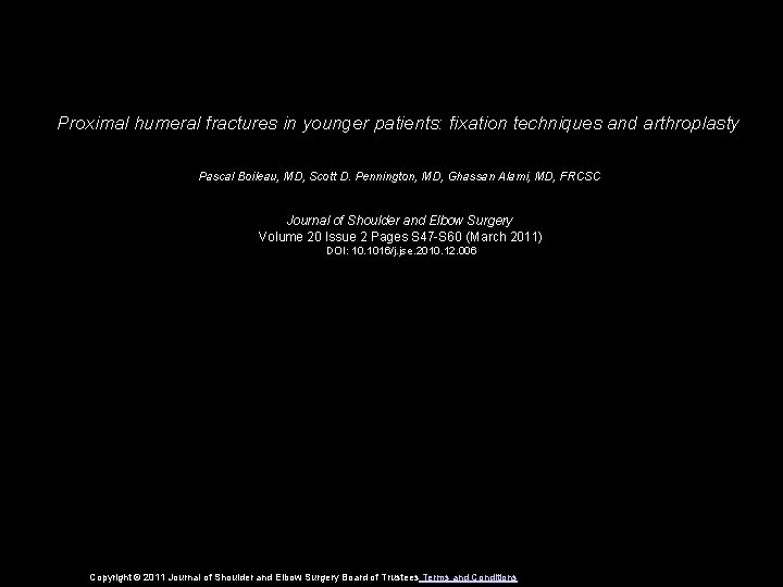 Proximal humeral fractures in younger patients fixation techniques