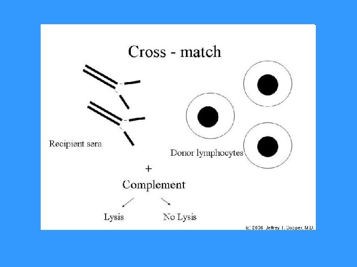 Transplantation Transplantation transfer of tissue or organ autologous