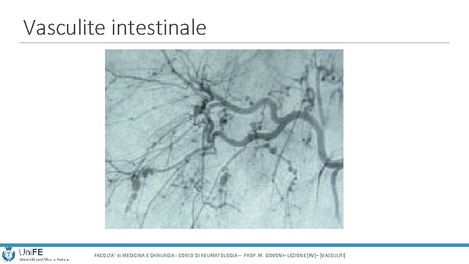 Inquadramento generale delle vasculiti sistemiche PROF MARCELLO GOVONI