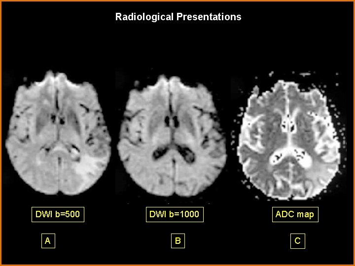 Radiological Category Neuroradiology Principal Modality 1 MRI Case