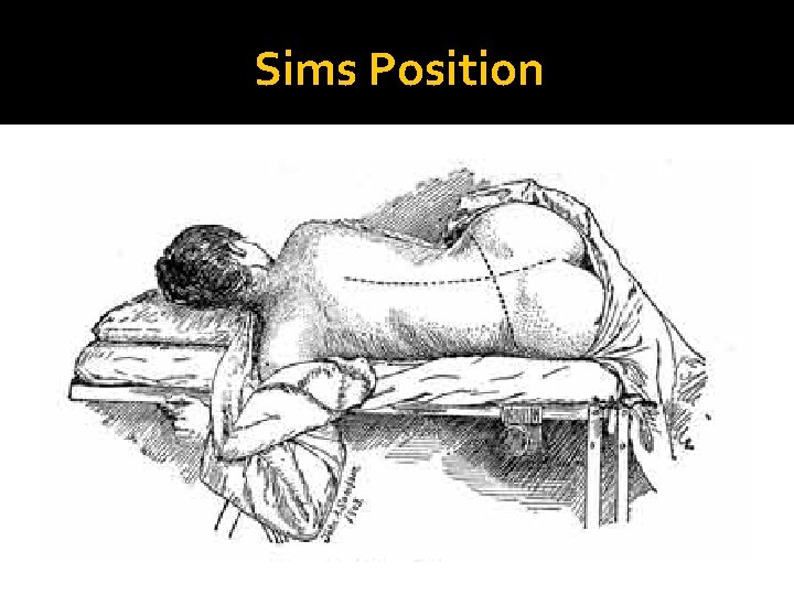 Midterm Barium Enema Large Intestine It begins in