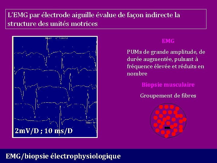 Electromyographie Cours 1 bases techniques Cours 2 EMG