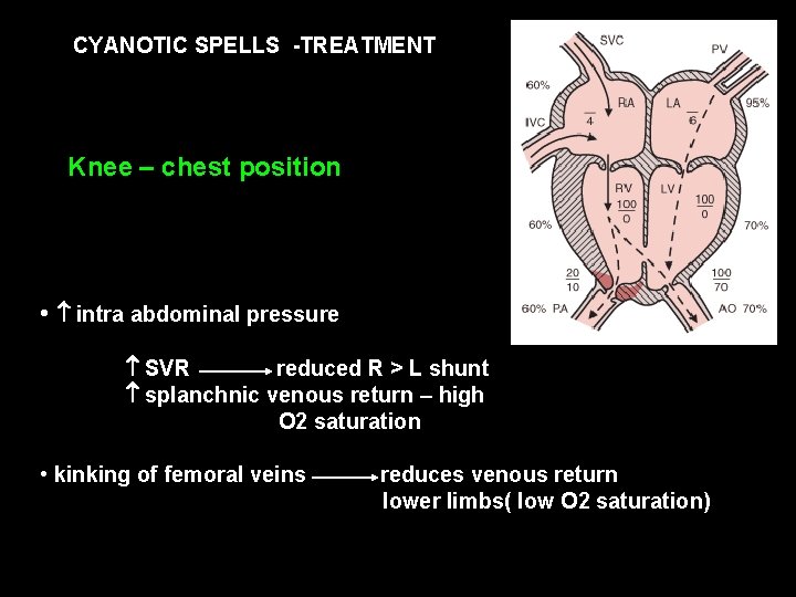 CYANOTIC SPELLS paroxysmal hyperpnea hypoxic spells anoxic spells